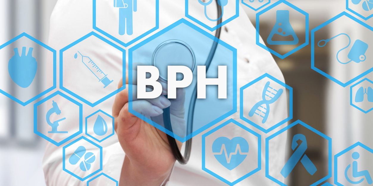 BPH Influenced by Several Factors – Urologic Institute